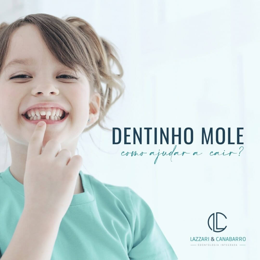 DENTE MOLE Lazzari Canabarro Odontologia Integrada DENTE MOLE Lazzari Canabarro Odontologia Integrada
